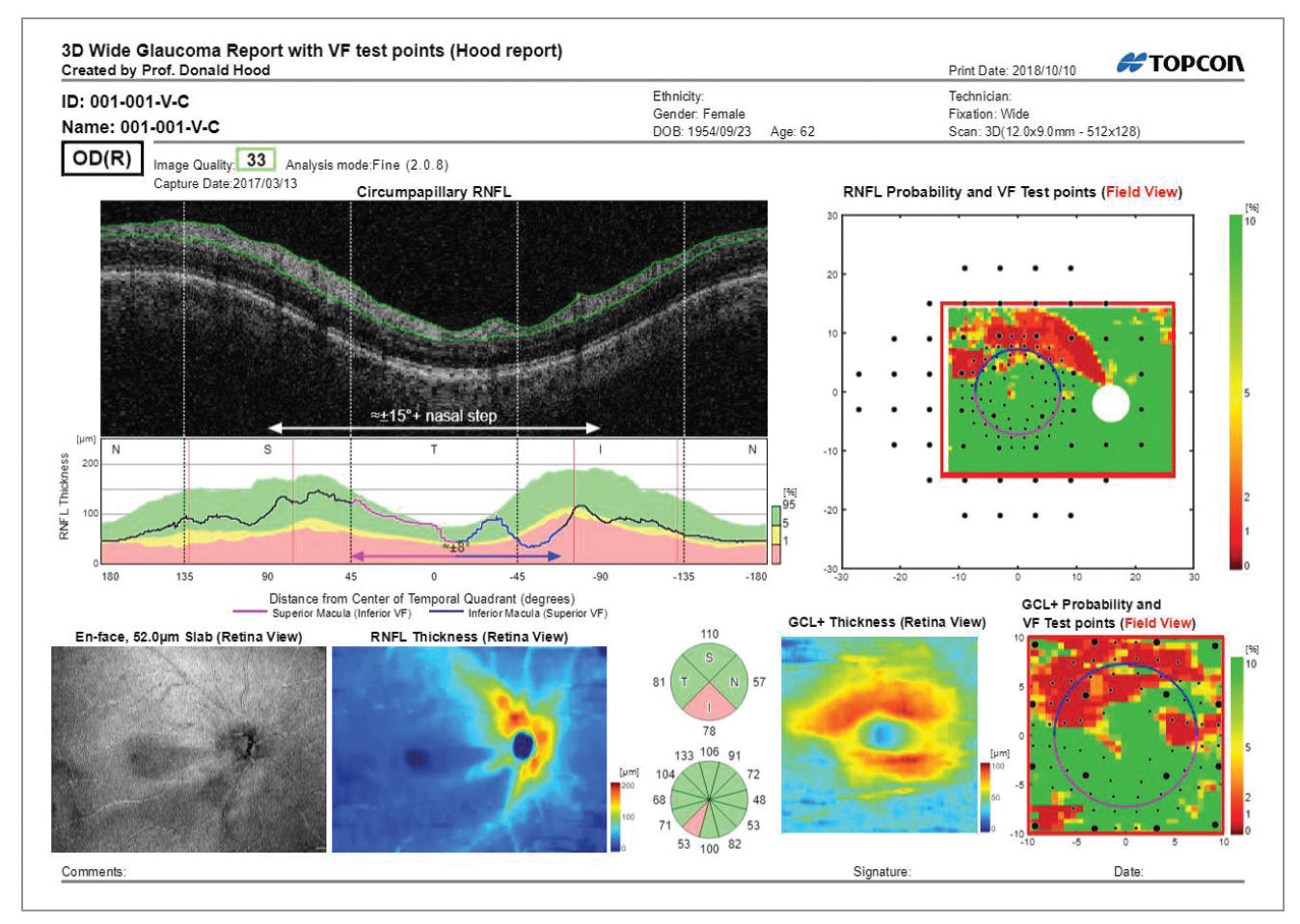 Topcon Maestro 2 - OCT and Fundus Camera