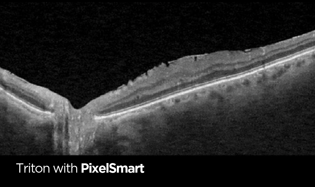 Triton - Topcon Healthcare