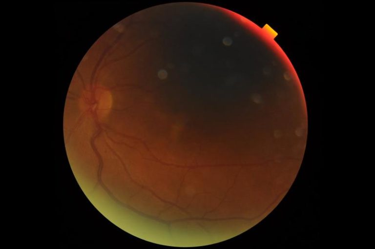 VIDEO: Implementing Myopia Management in Your Practice | Topcon Healthcare