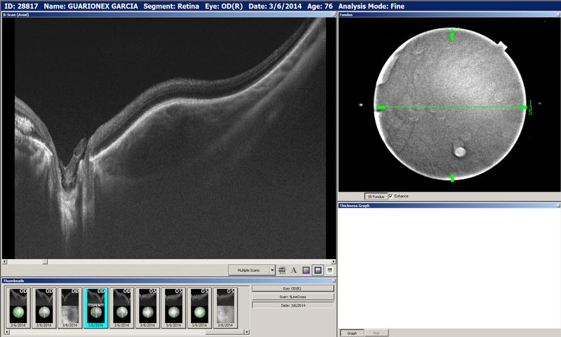 Benefits of Remote Refraction | Topcon Healthcare