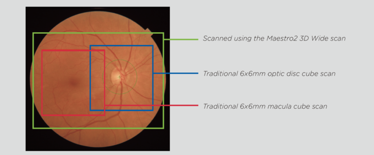 Efficiency in OCT Imaging: The Benefits of a Multi-Modality, Automated OCT