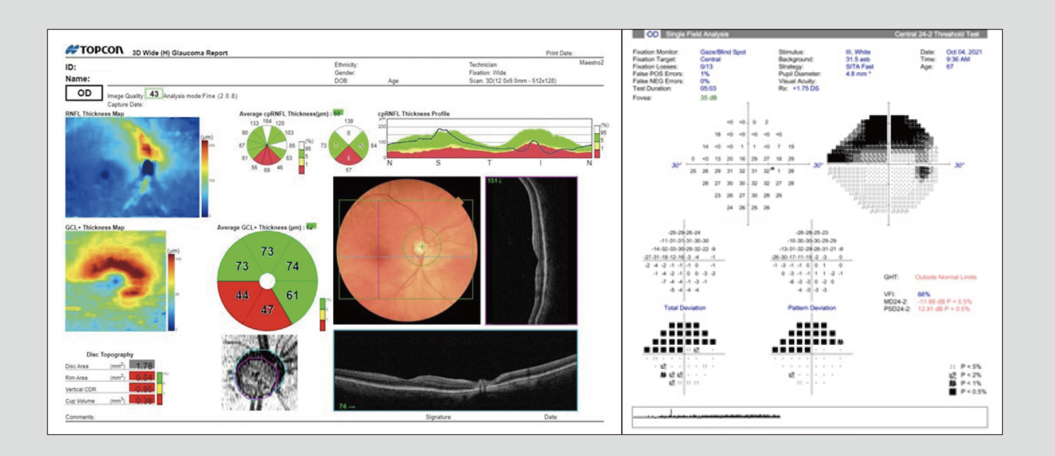 Efficiency in OCT Imaging: The Benefits of a Multi-Modality, Automated OCT