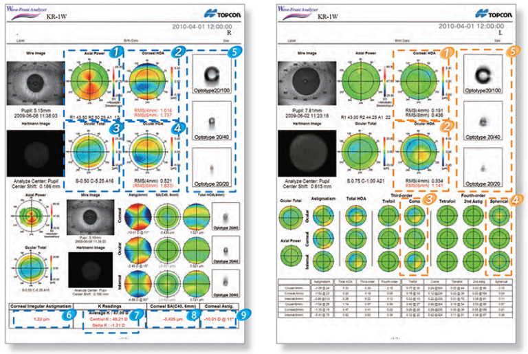 KR-1W Corneal Wavefront Analyzer