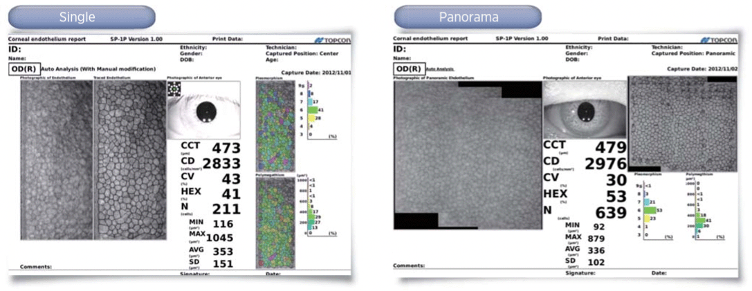 SP-1P Specular Microscope