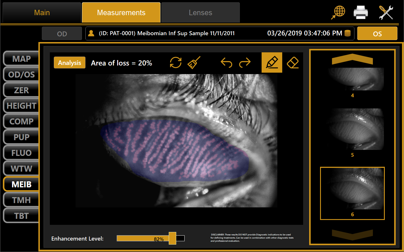Topcon Tech: Meibography & Myopia Management Integration