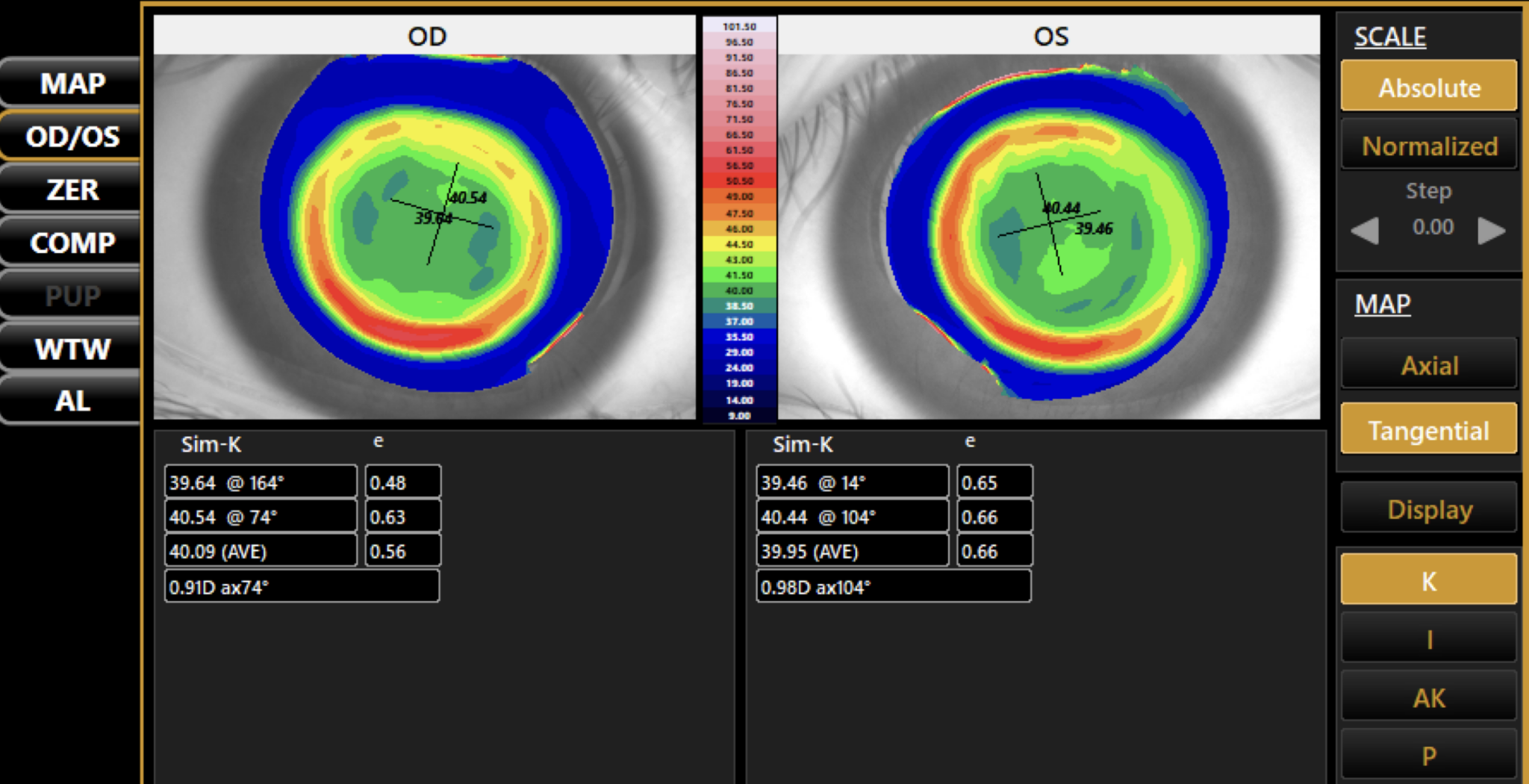 Elevate Your Myopia-Management Practice Using the | Topcon