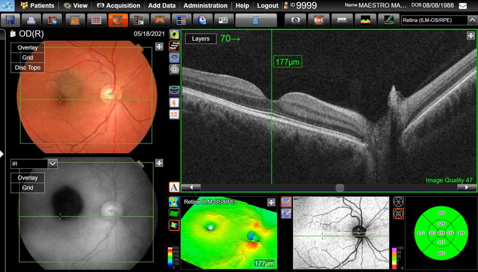 Topcon's Maestro2 OCT: Revolutionizing Eye-Care