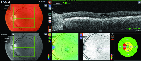 The Importance of Image Quality in Accurate Diagnosis | Topcon Healthcare
