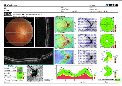 ‘Must-Have’ OCT Technology for Today’s Cataract & Refractive Surgeon ...