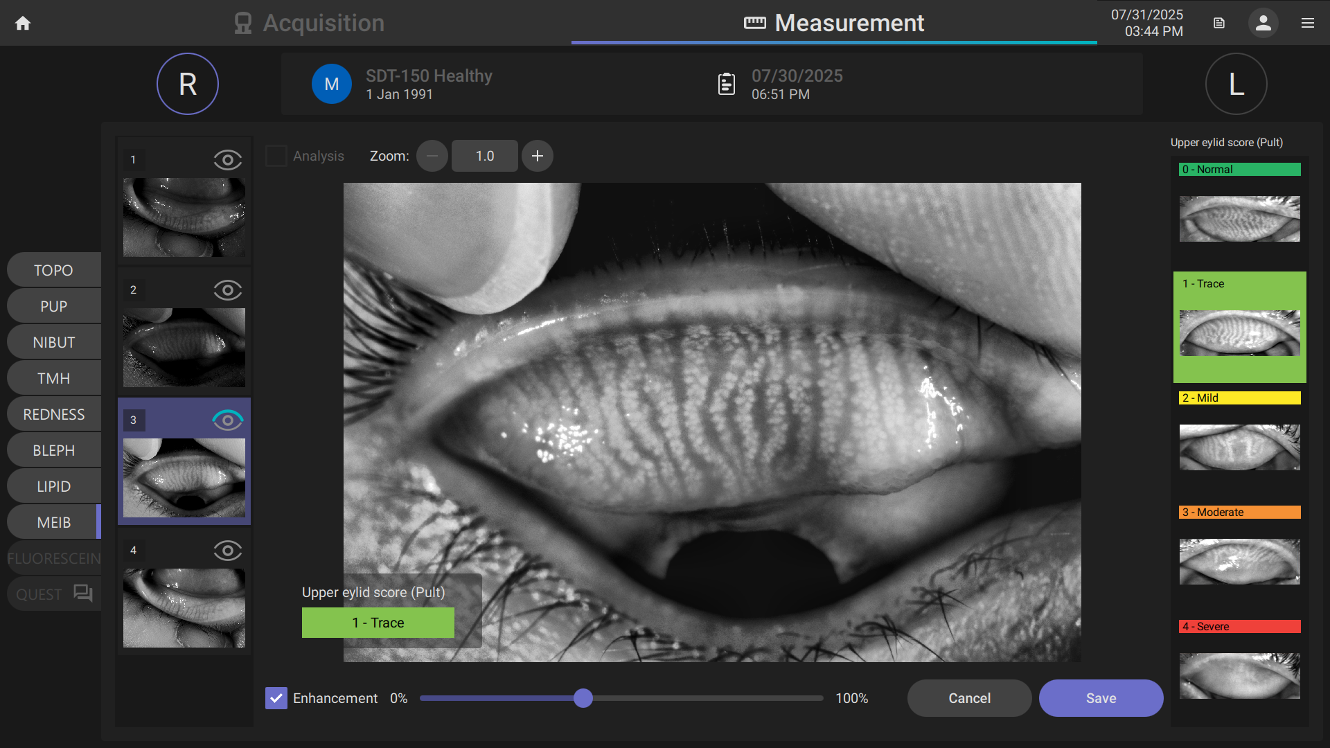TERA Dry Eye Imager™ | Topcon Healthcare